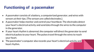 Pacemaker - Basic Information | PPT