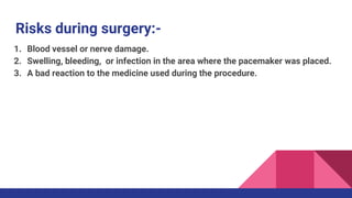 Pacemaker - Basic Information | PPT