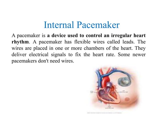 Bio-Medical Therapeutic of in Pacemaker& Respiratory | PPTX | First Aid ...