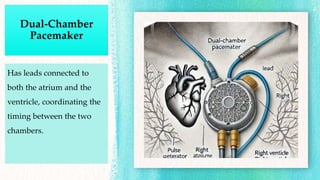Pacemaker.pptx