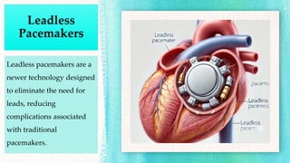 Pacemaker.pptx