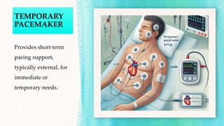 Pacemaker.pptx