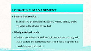 Pacemaker.pptx