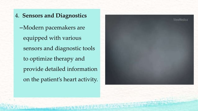 Pacemaker.pptx