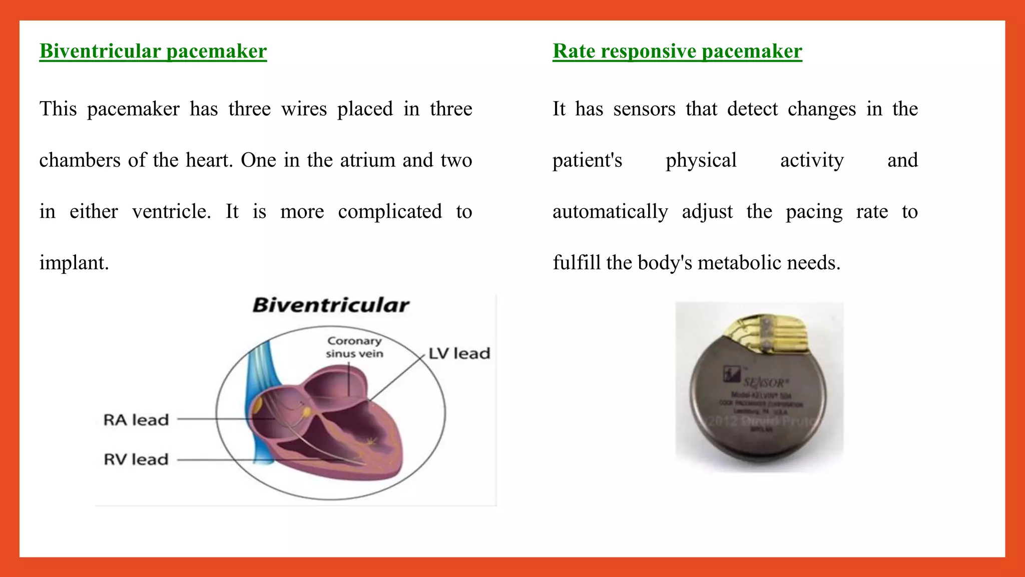 Pacemaker | PPTX