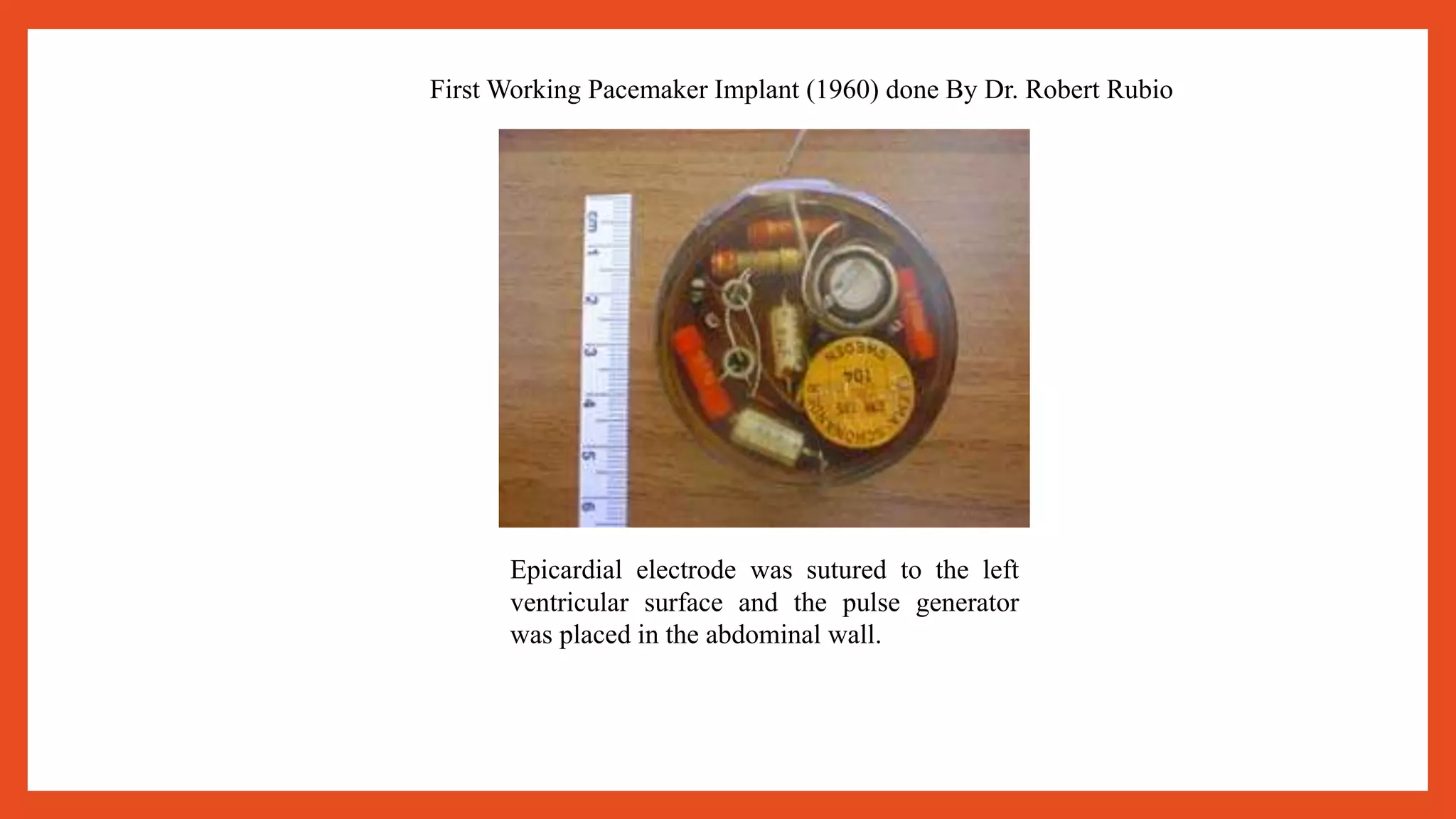 Pacemaker | PPTX