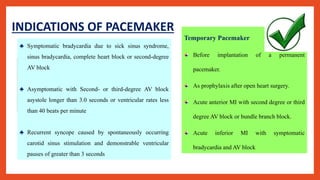 Pacemaker | PPTX