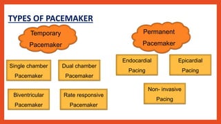 Pacemaker | PPTX