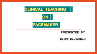 Pacemaker | PPTX