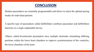 Pacemaker | PPTX