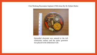Pacemaker | PPTX