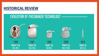 Pacemaker | PPTX