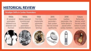 Pacemaker | PPTX