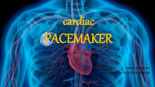 Pacemaker | PPTX