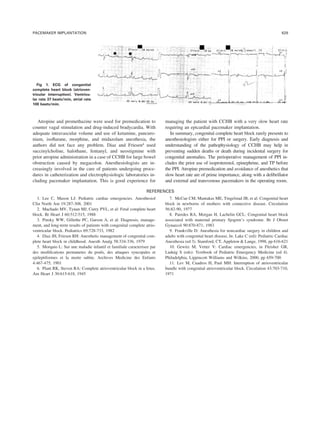 perioperative management Pacemaker Insertion In Congenital Heart | PDF