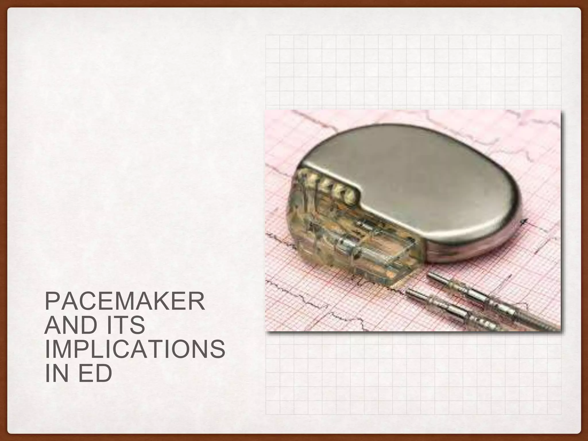 Cardiac Pacemakers - Basics | PPTX