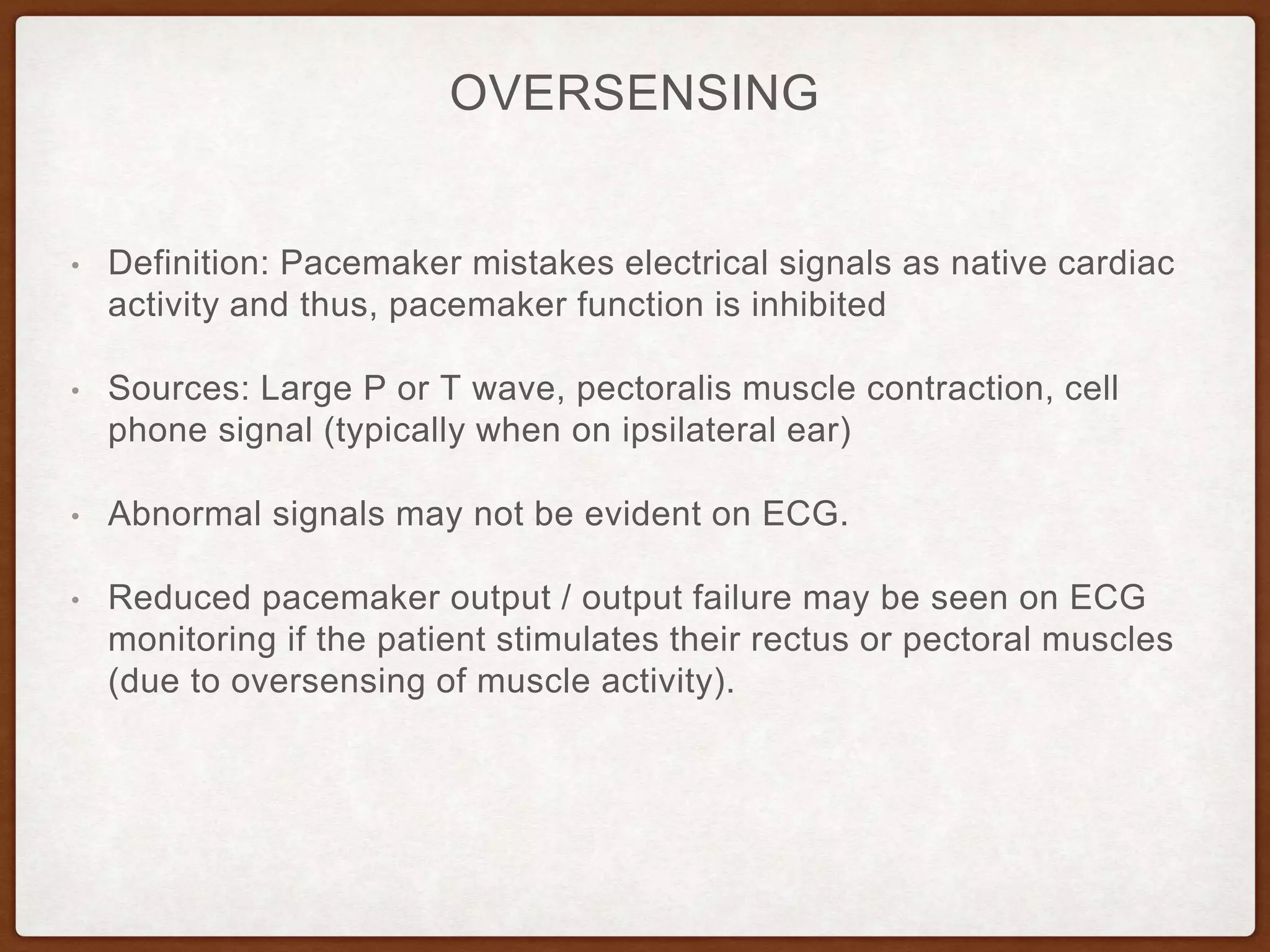 Cardiac Pacemakers - Basics | PPTX