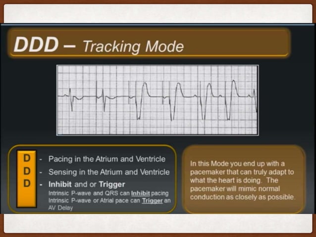 Cardiac Pacemakers - Basics | PPTX | Heart and Cardiovascular Diseases ...