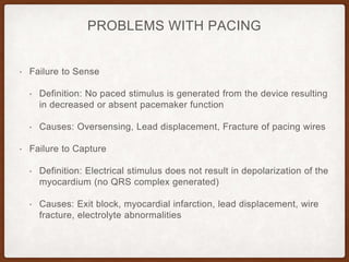 Cardiac Pacemakers - Basics | PPTX