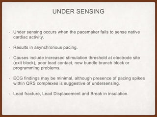 Cardiac Pacemakers - Basics | PPTX
