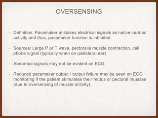 Cardiac Pacemakers - Basics | PPTX