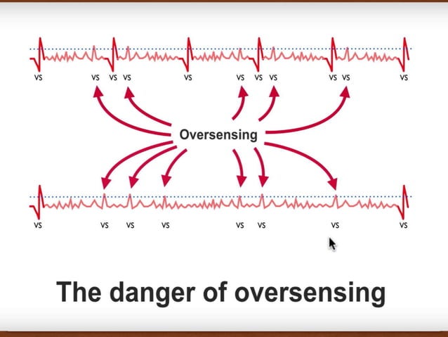 Cardiac Pacemakers - Basics | PPTX | Heart and Cardiovascular Diseases ...