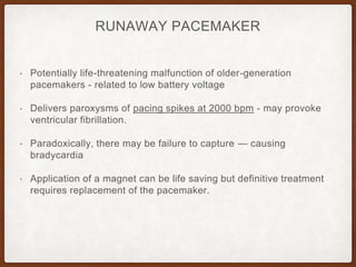 Cardiac Pacemakers - Basics | PPTX