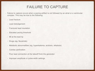 Cardiac Pacemakers - Basics | PPTX