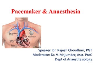 Pace maker anaesthesia | PPTX