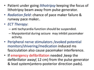 Pace maker anaesthesia | PPTX