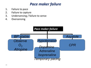 Pace maker anaesthesia | PPTX