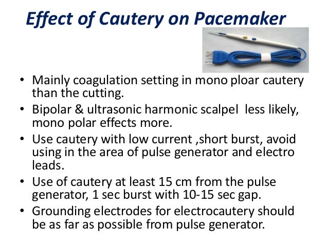 Pace maker anaesthesia