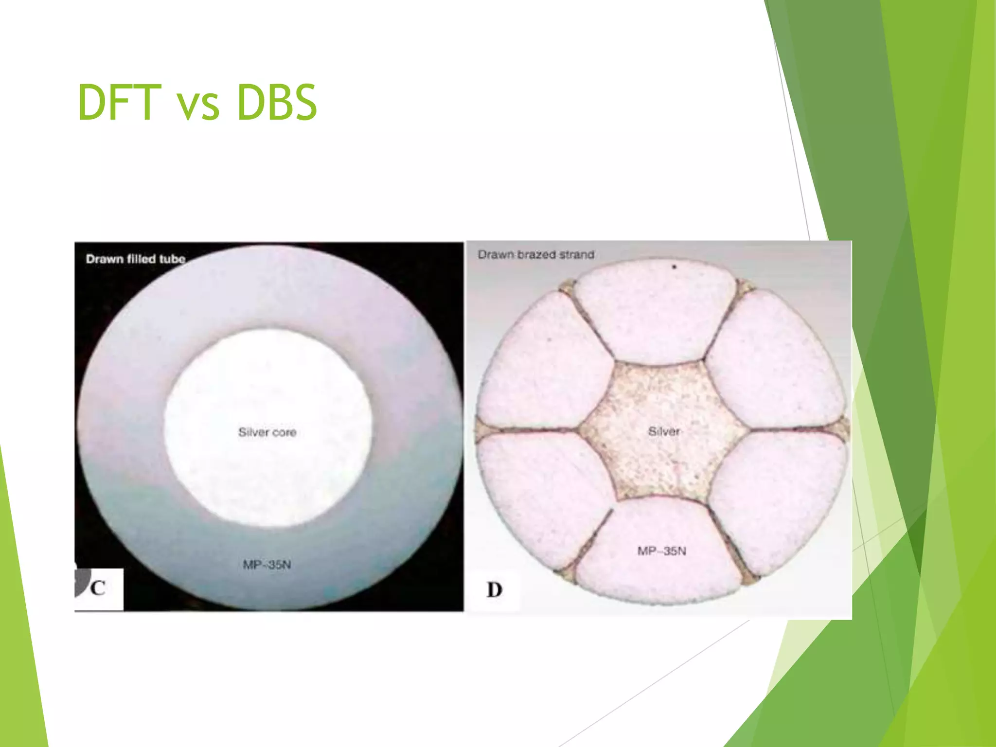 PACEMAKER BASIC AND TIMING CYCLE .pptx