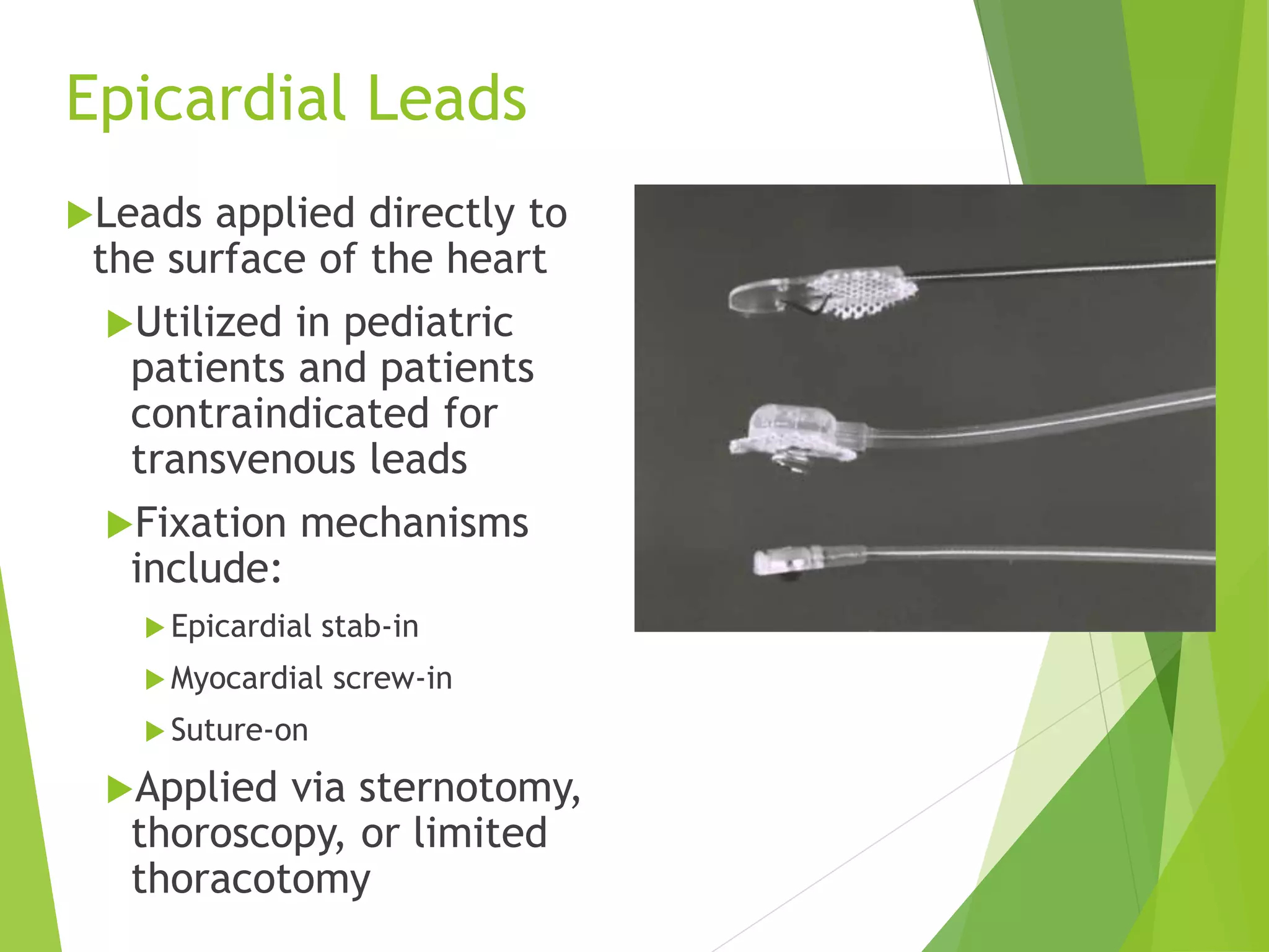 PACEMAKER BASIC AND TIMING CYCLE .pptx