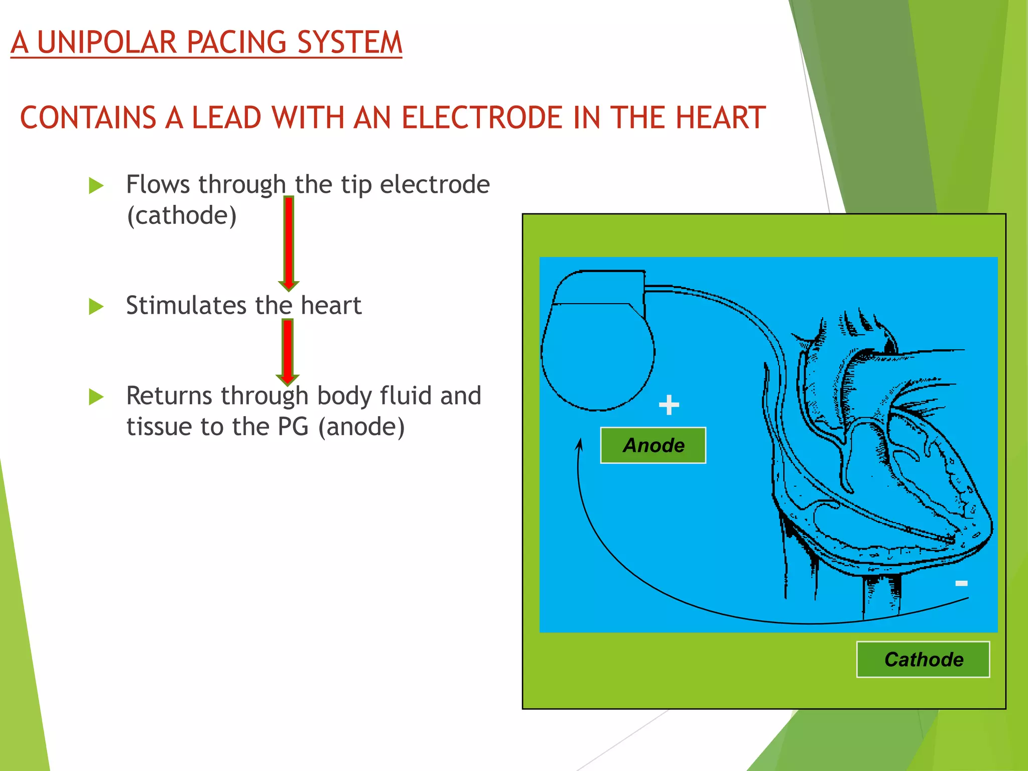 PACEMAKER BASIC AND TIMING CYCLE .pptx