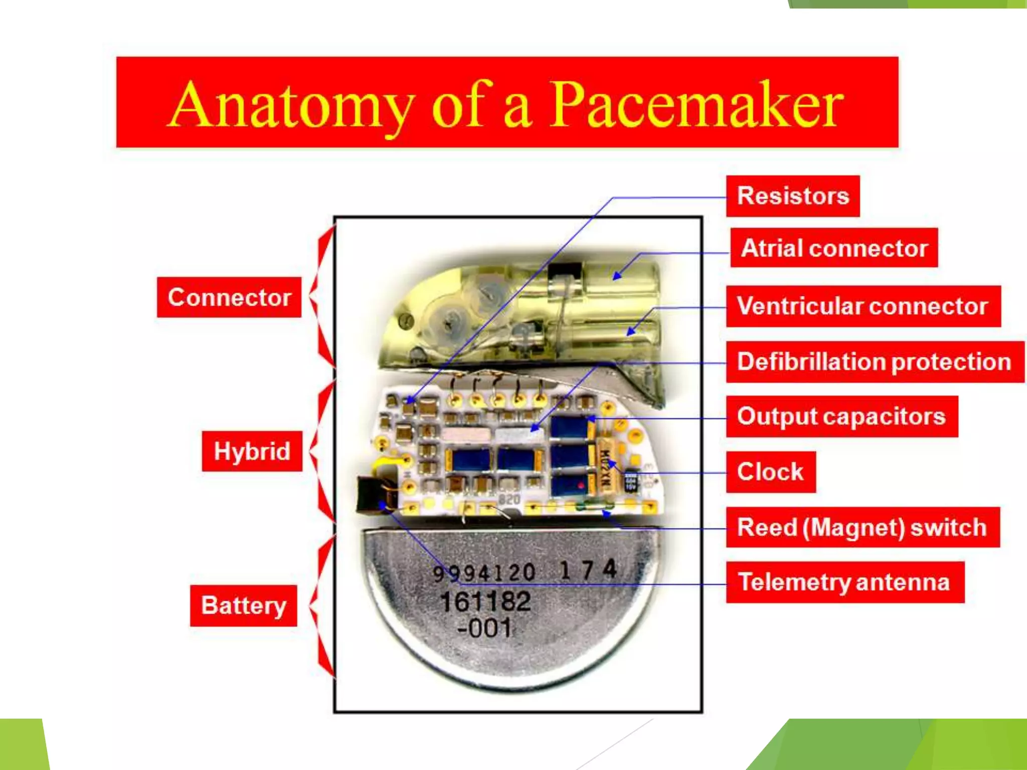 PACEMAKER BASIC AND TIMING CYCLE .pptx | Heart and Cardiovascular ...