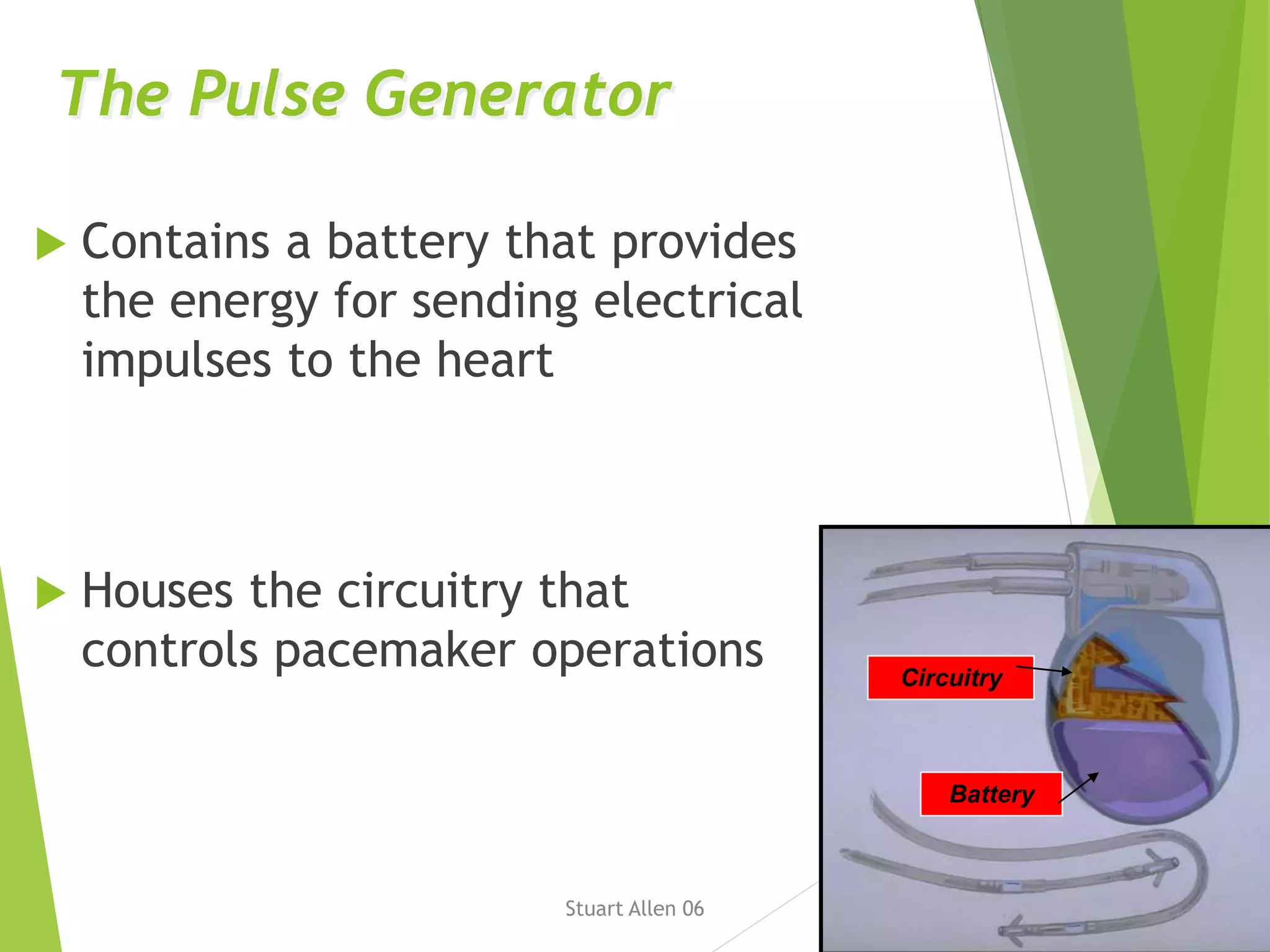 PACEMAKER BASIC AND TIMING CYCLE .pptx