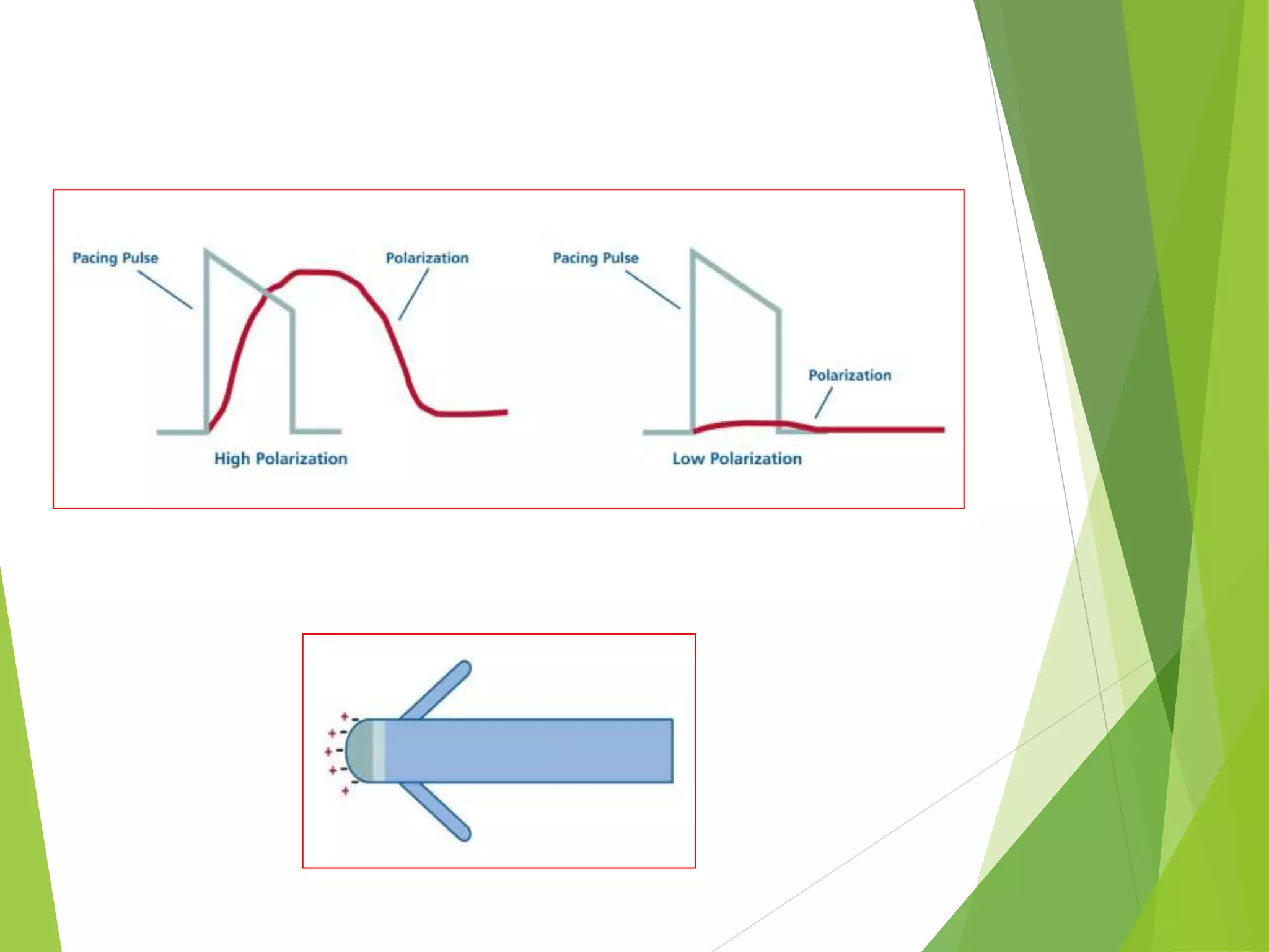 PACEMAKER BASIC AND TIMING CYCLE .pptx