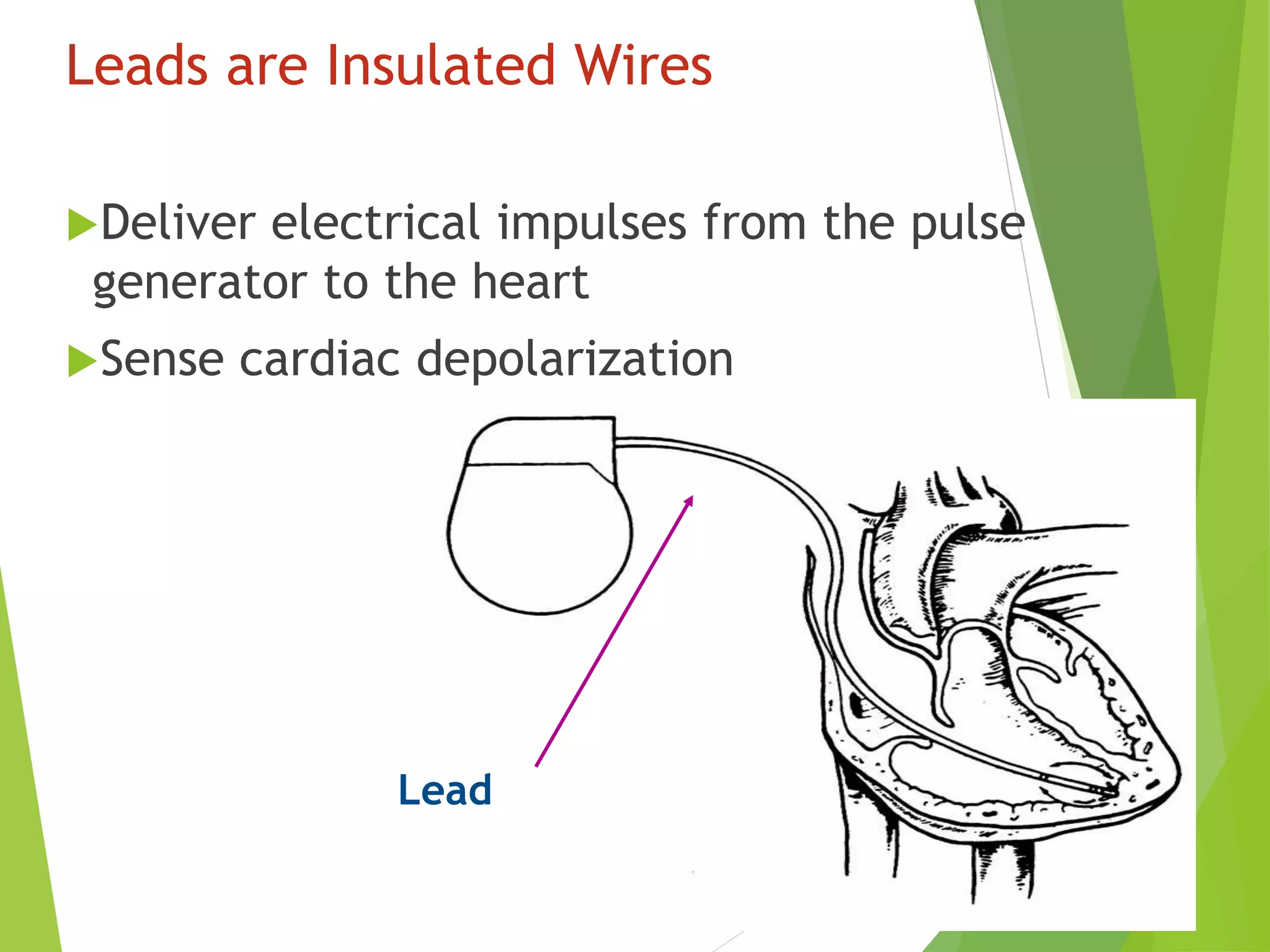 PACEMAKER BASIC AND TIMING CYCLE .pptx
