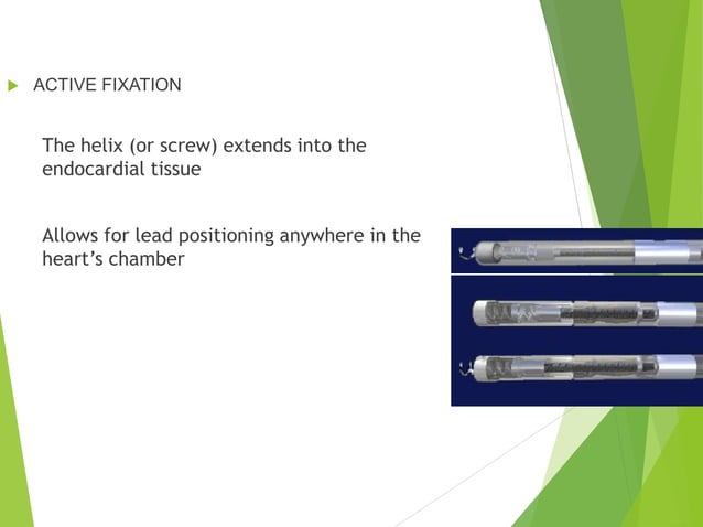 PACEMAKER BASIC AND TIMING CYCLE .pptx | Heart and Cardiovascular ...