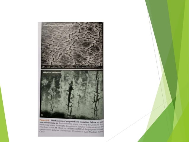 PACEMAKER BASIC AND TIMING CYCLE .pptx | Heart and Cardiovascular ...