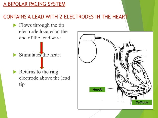 PACEMAKER BASIC AND TIMING CYCLE .pptx | Heart and Cardiovascular ...