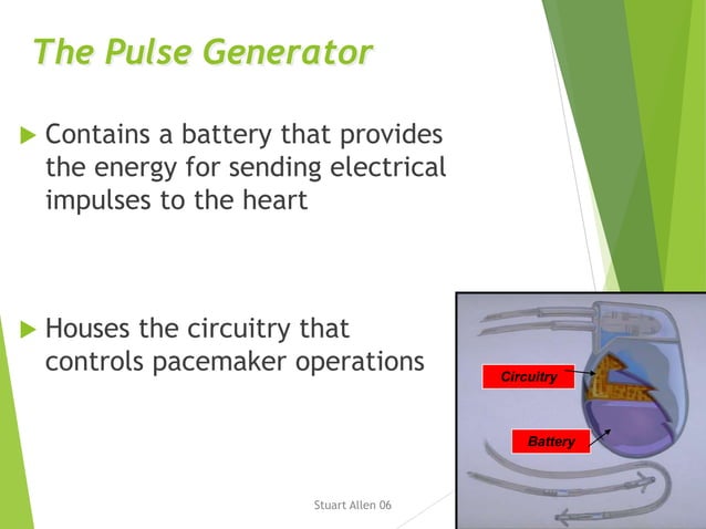 PACEMAKER BASIC AND TIMING CYCLE .pptx | Heart and Cardiovascular ...