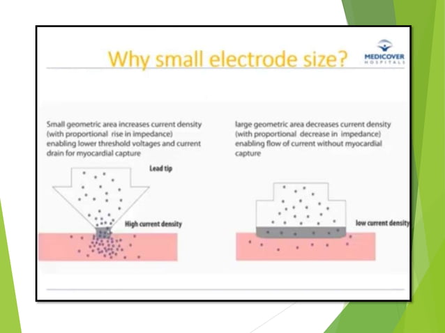 PACEMAKER BASIC AND TIMING CYCLE .pptx | Heart and Cardiovascular ...