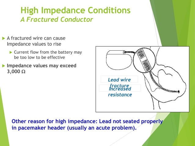 PACEMAKER BASIC AND TIMING CYCLE .pptx | Heart and Cardiovascular ...