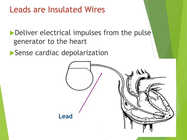 PACEMAKER BASIC AND TIMING CYCLE .pptx | Heart and Cardiovascular ...