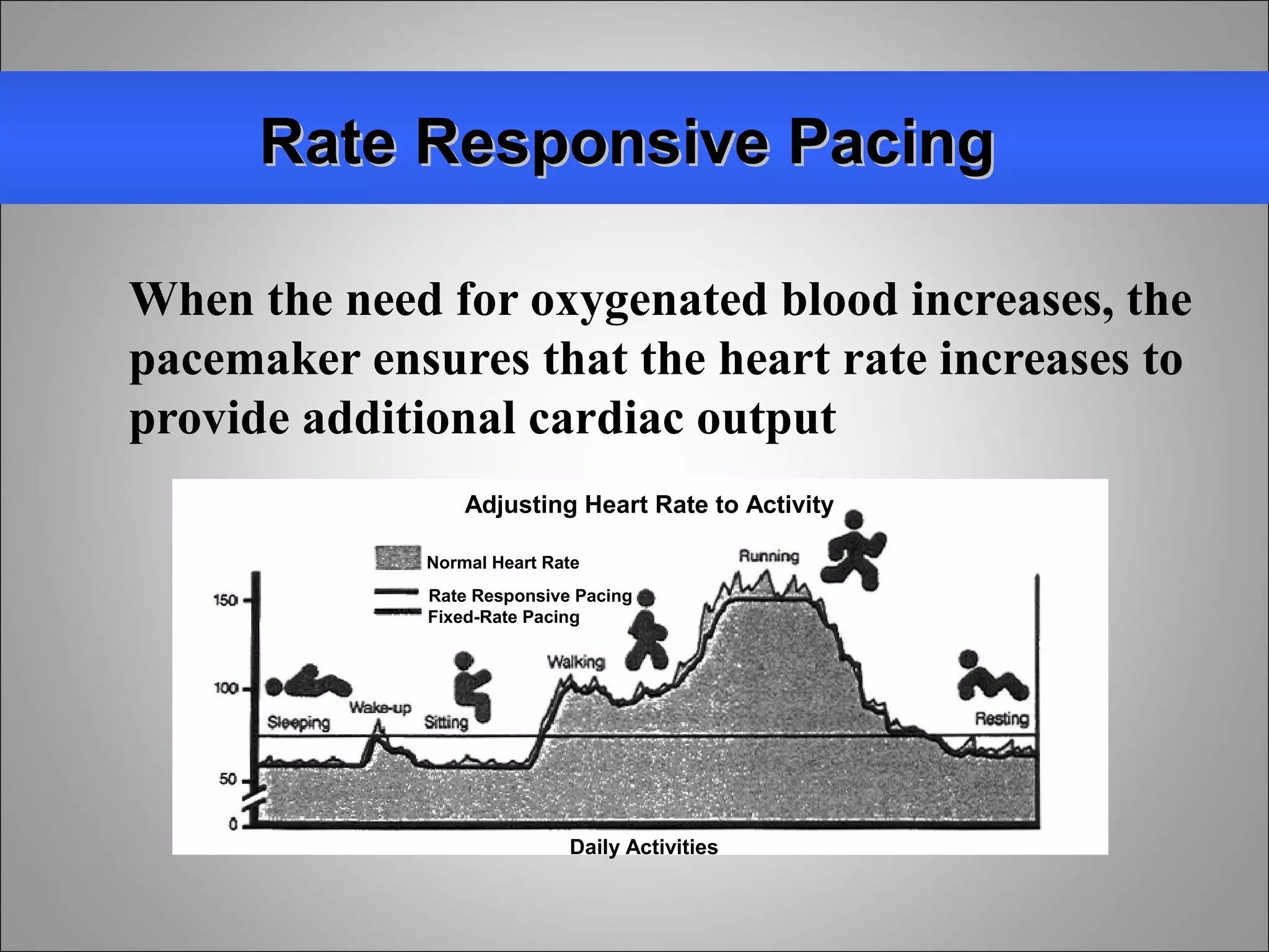 Pacemaker basics | PPT
