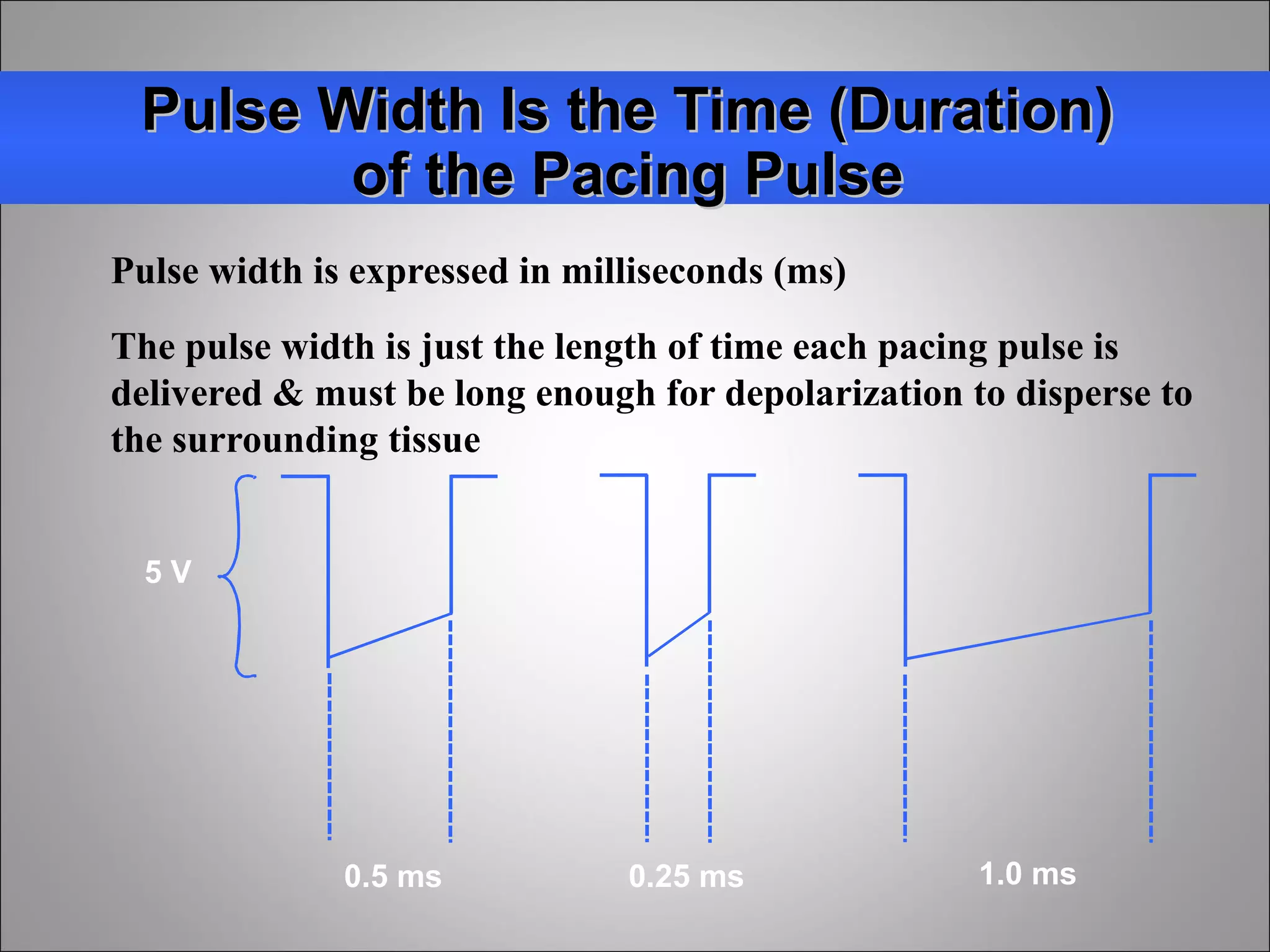 Pacemaker basics | PPT