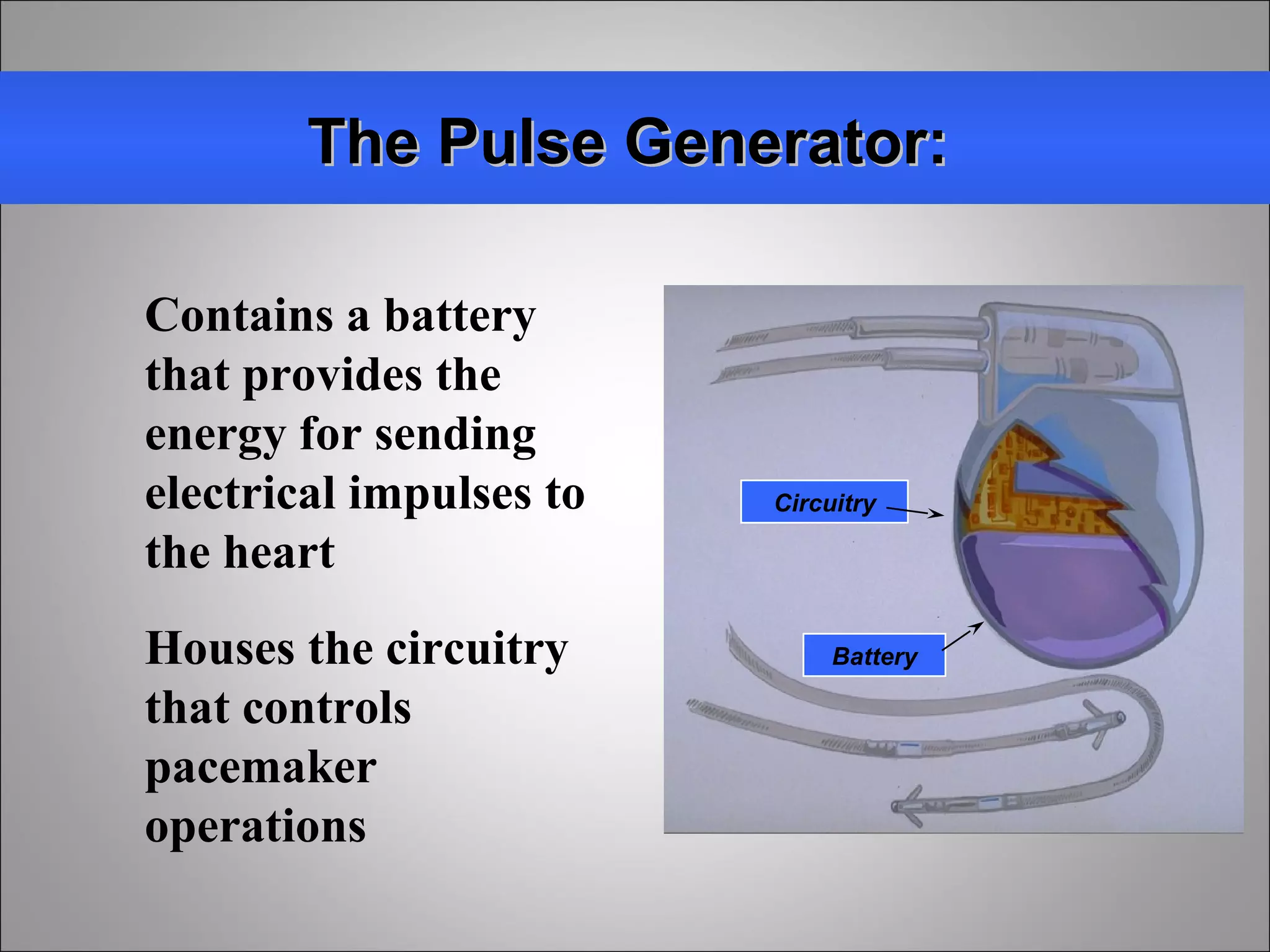 Pacemaker basics | PPT
