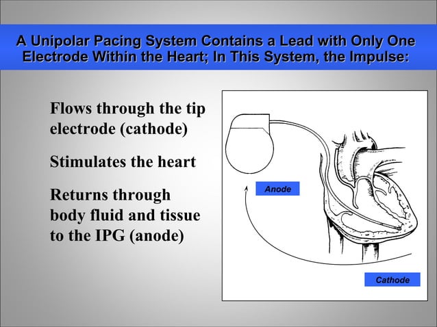 Pacemaker basics | PPT